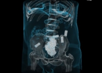 Bring Home Souvenirs From Your Holiday Vacation, Not Drugs